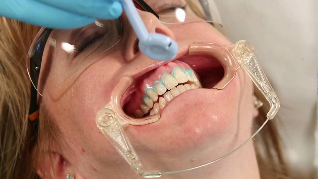 Opalustre Step by Step - YouTube