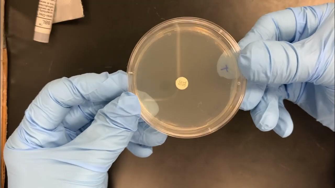 Evolution of antibiotic resistance lab, Clinical Microbiology - YouTube