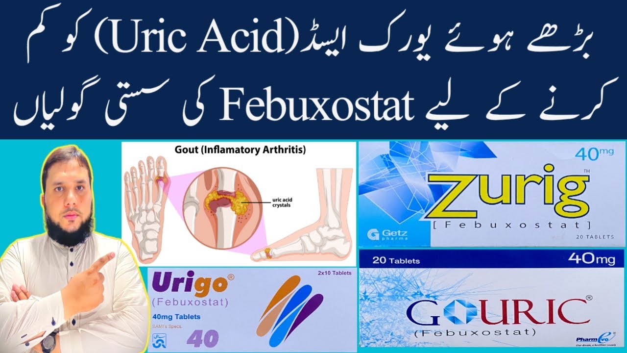 Low Cost Tablet For Uric Acid | Gout Treatment & Medications Treat and ...