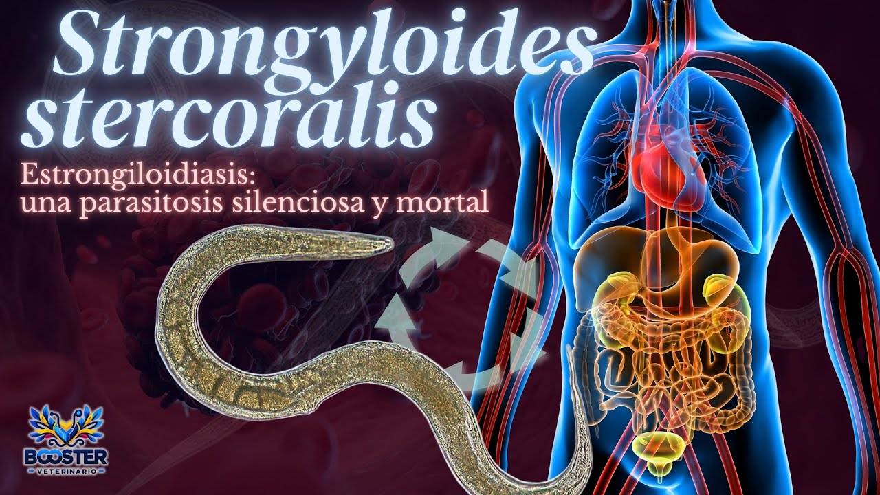 Estrongiloidiasis, una parasitosis silenciosa y potencialmente mortal ...