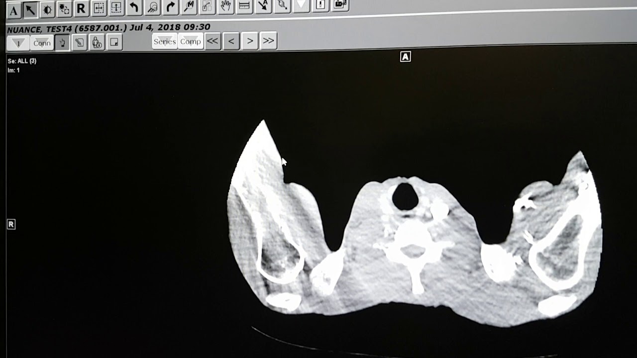 MIC READING OUT WHAT FIELD YOU ARE IN - YouTube