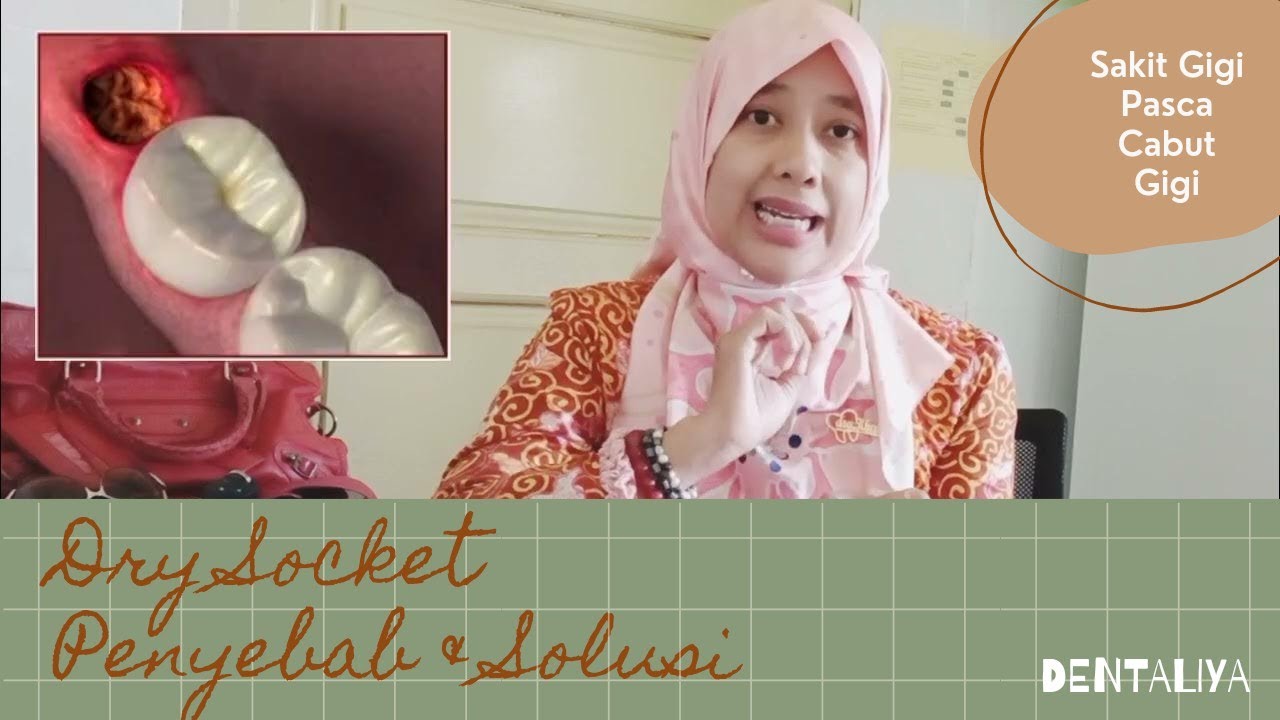 DRY SOCKET.....SAKIT GIGI HEBAT KARENA INFEKSI PASCA CABUT GIGI ...