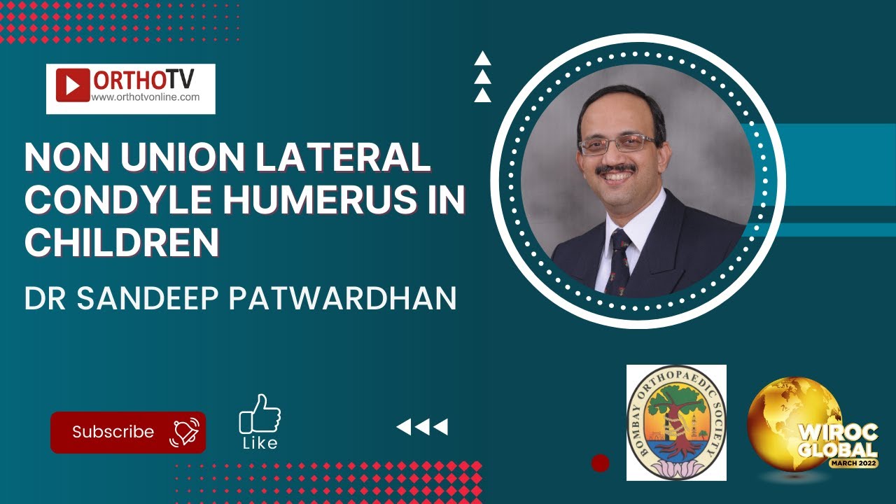 Non Union Lateral Condyle Humerus in Children - Dr Sandeep Patwardhan ...