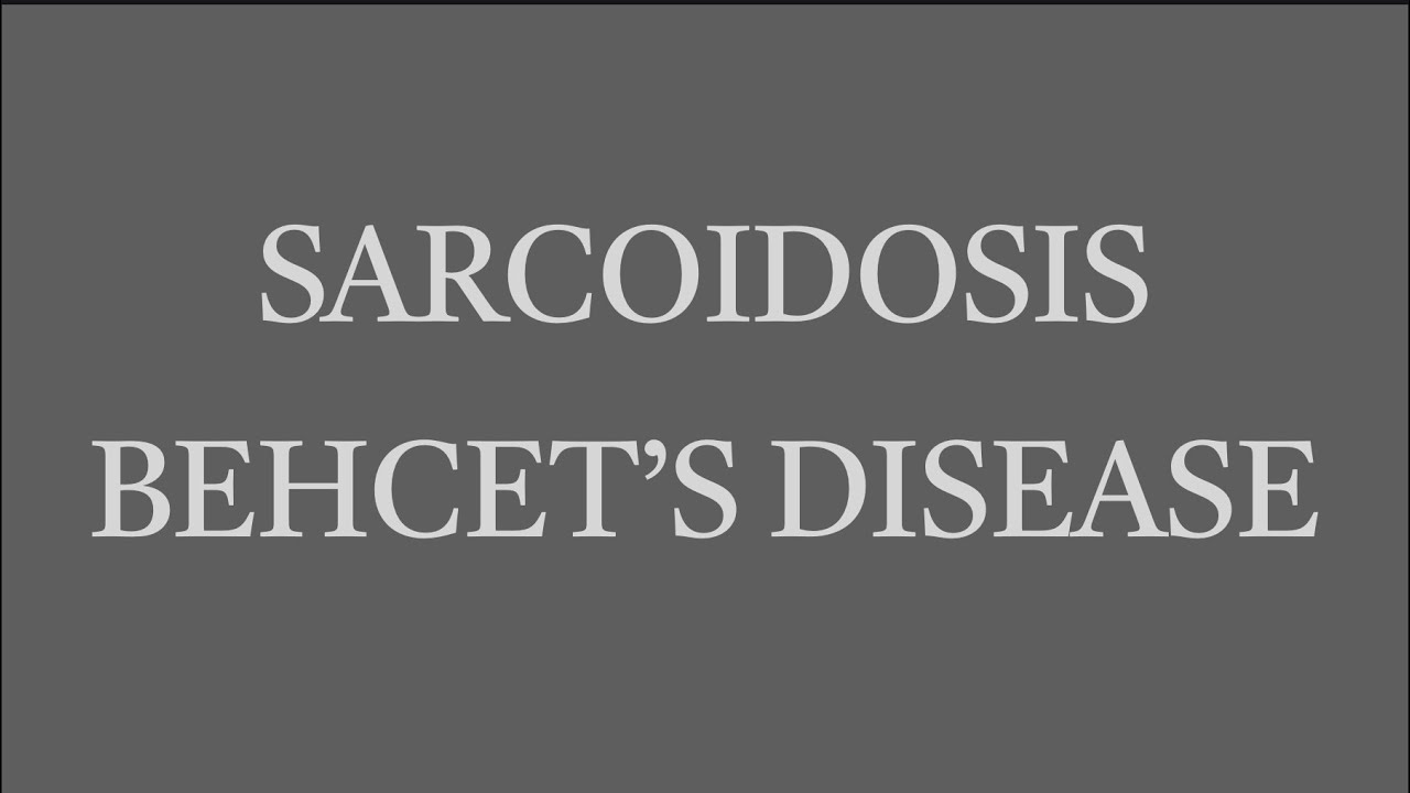 Uveitis: Session 08: Non-infectious Panuveitis (Sarcoidosis, Behcet ...
