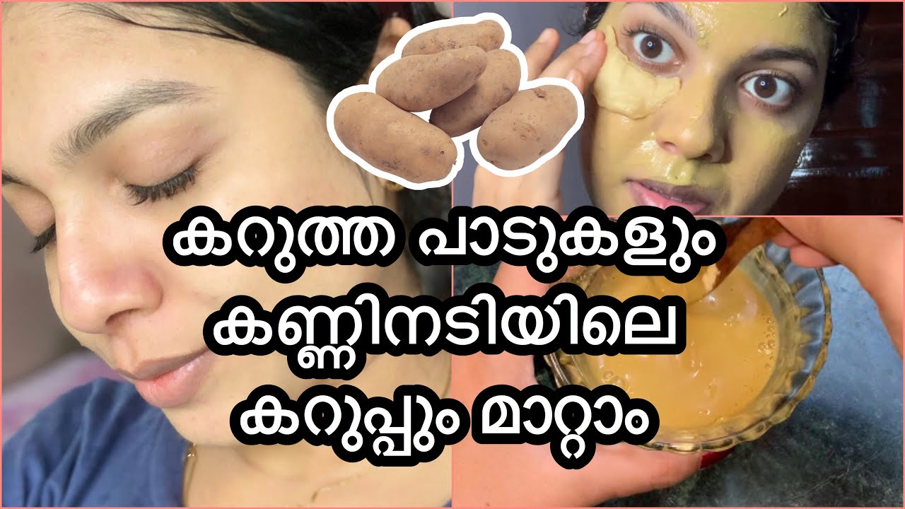 Potato കൊണ്ട് dark circles, acne marks, dark spots, hyperpigmentation ...