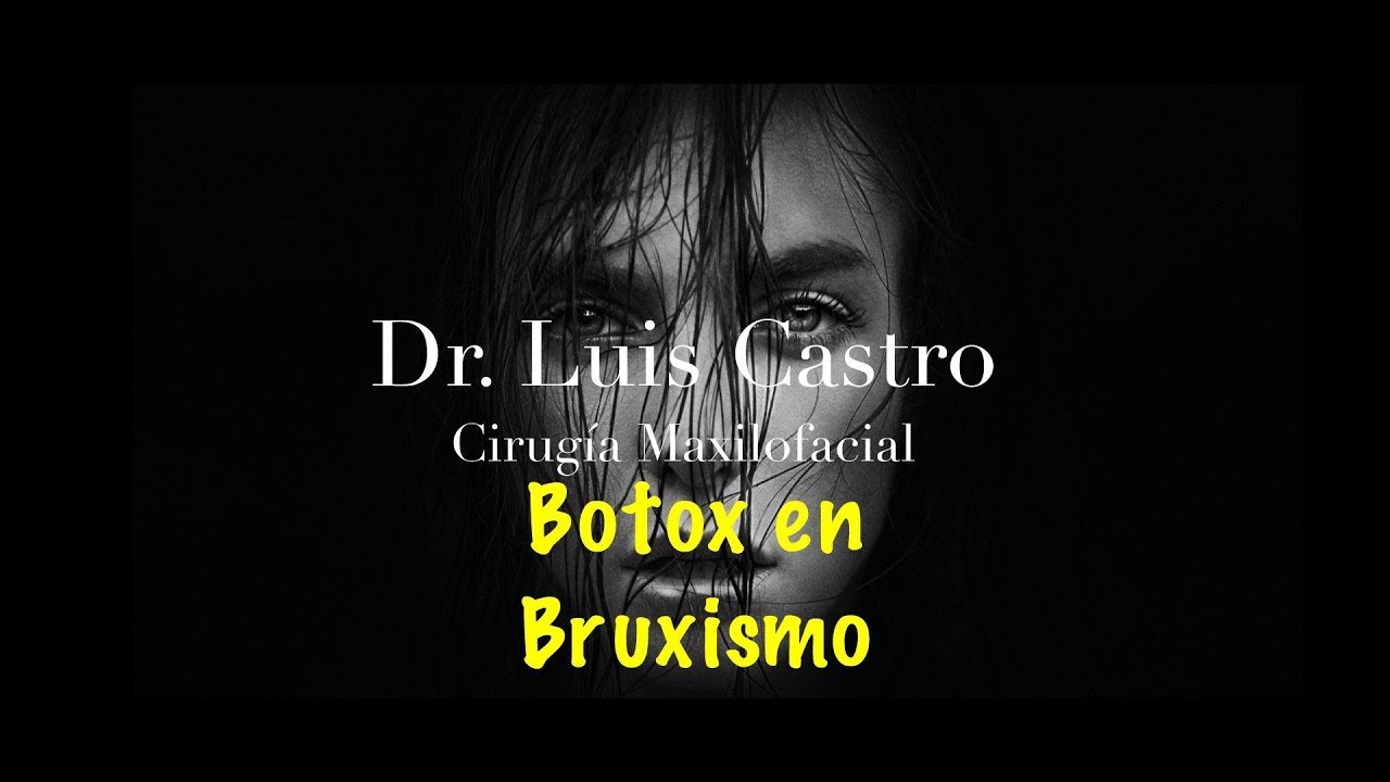 Botox en Bruxismo e Hipertrofia de Músculo Masetero - YouTube