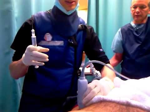 Recorded my Surgery without anesthesia.mp4 - YouTube