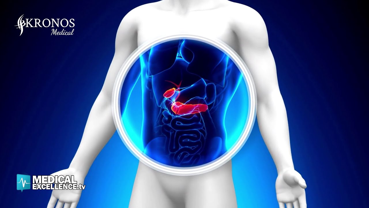 Calcoli alla cistifellea o colecisti: sintomi, intervento e trattamento ...