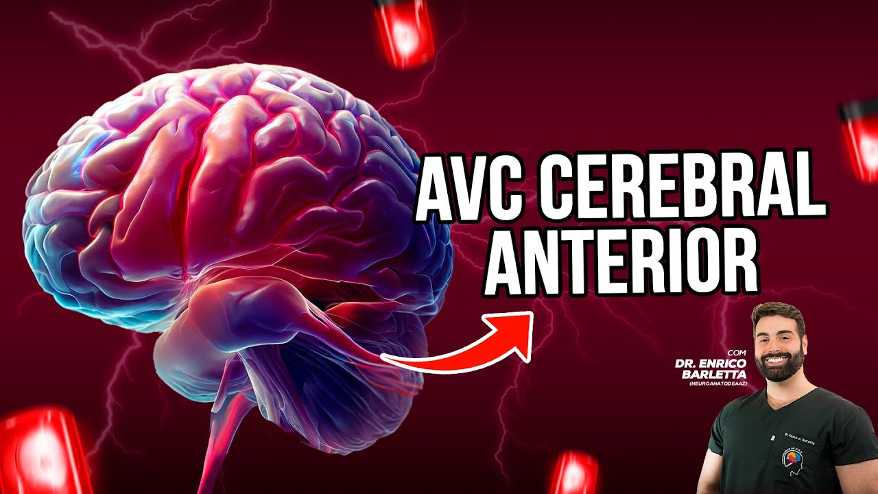 ENTENDA TUDO SOBRE O AVC DA CEREBRAL ANTERIOR - YouTube