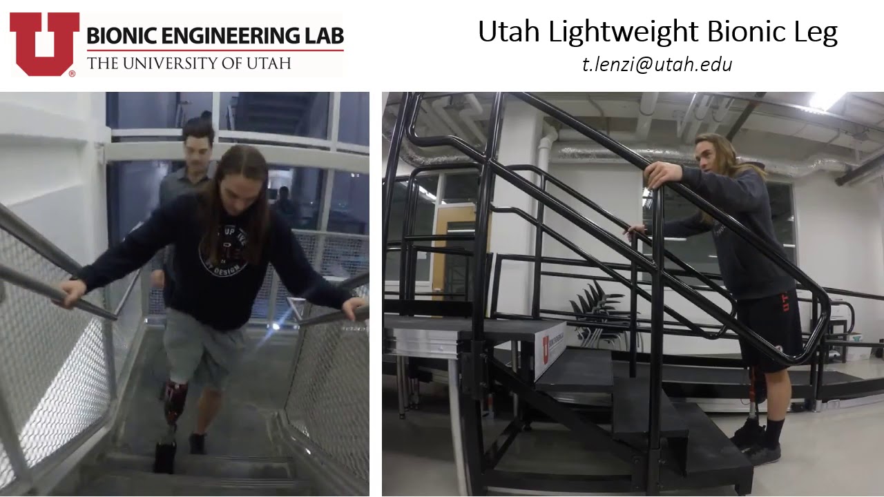 Utah Bionic Leg Prosthesis - Ambulation on Stairs - Above-knee amputee ...