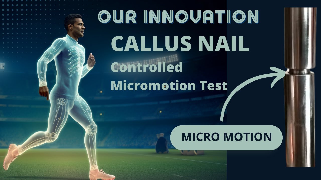 Callus Nail Controlled Micromotion Test - YouTube