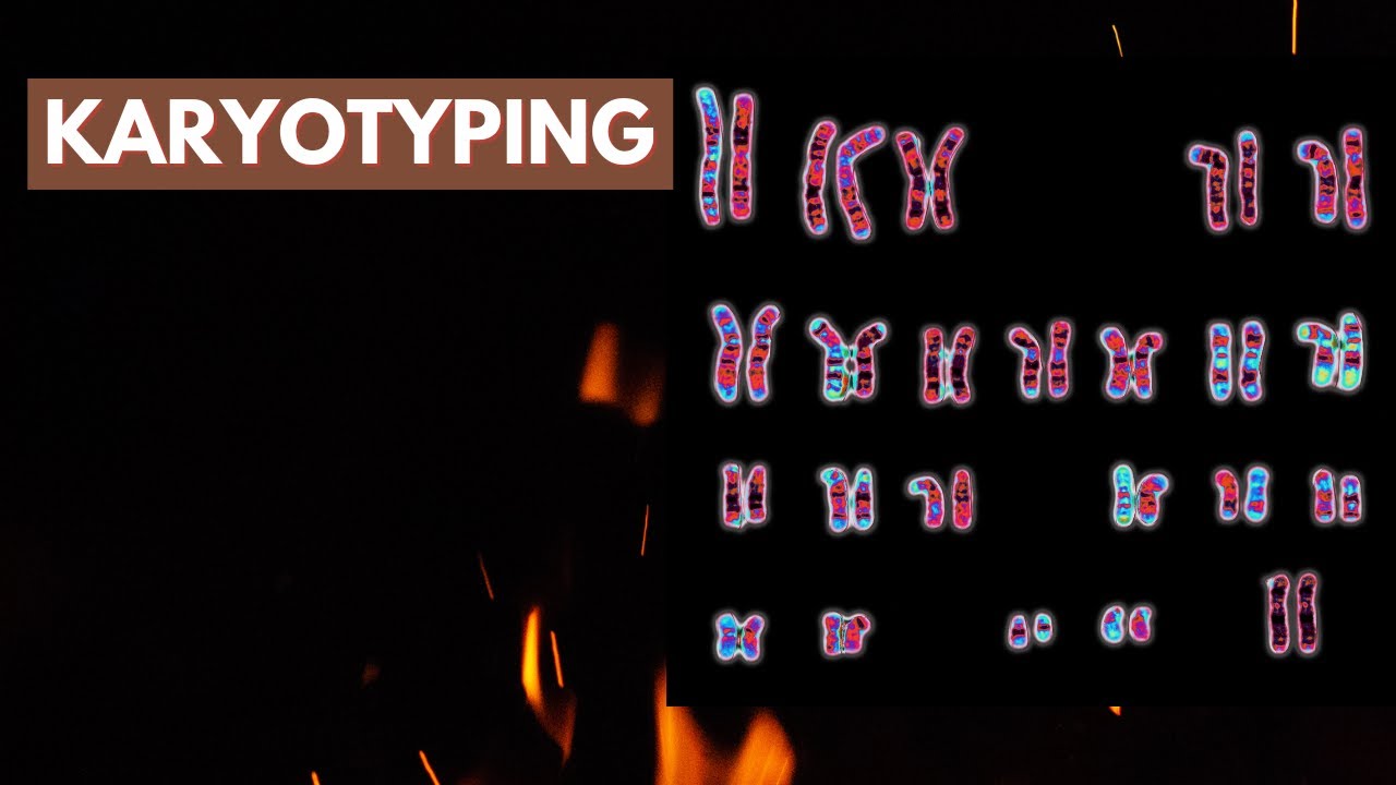 Karyotyping | Human Genetics | Cytogenetics - YouTube