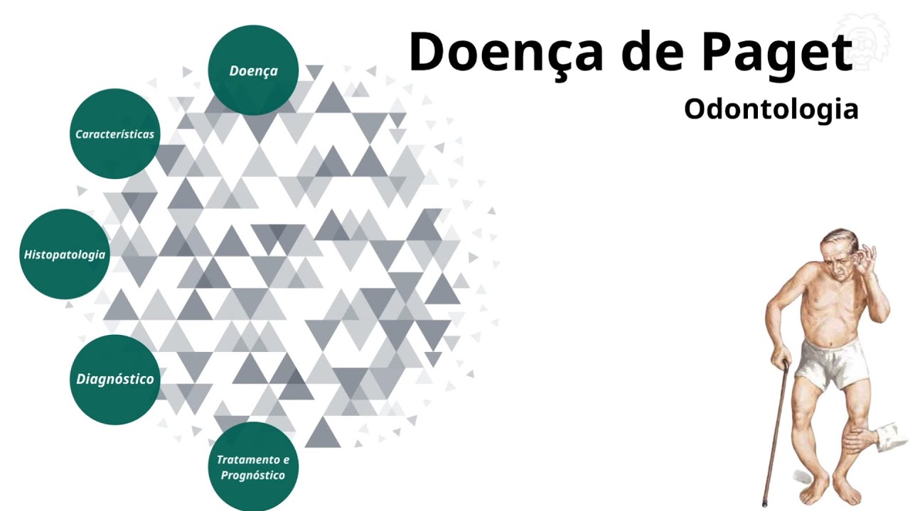 Doença de Paget - OdontoCards - YouTube