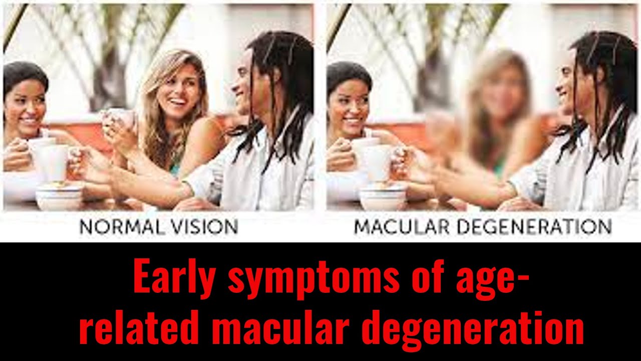 Don't Miss These Early Warning Signs of Age-Related Macular ...