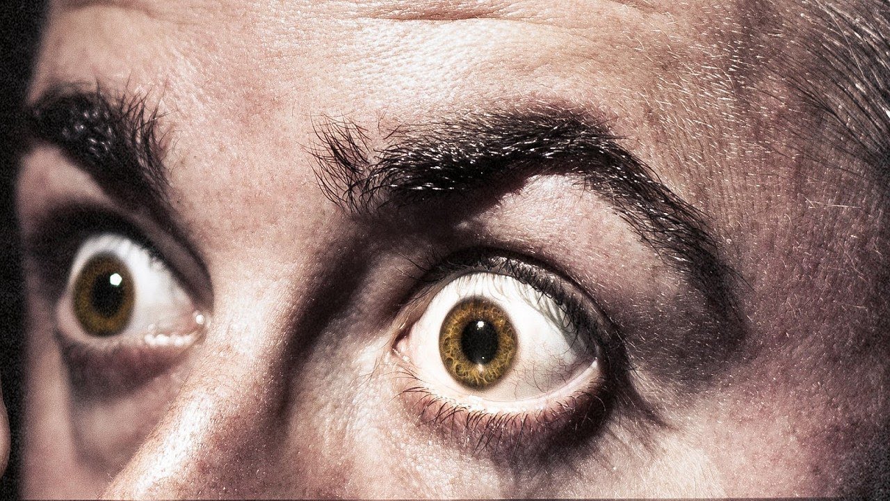 Dry eye from not blinking enough During Game Play - YouTube