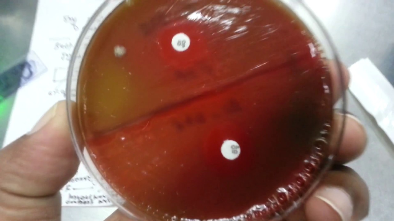 Dry India ink prepartion of Streptococcus pneumoniae observed under ...
