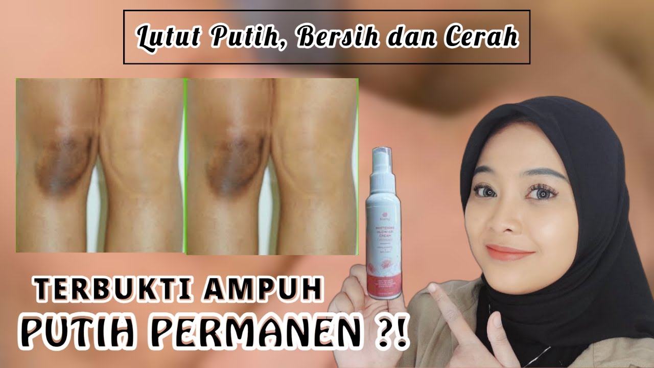 CARA MEMUTIHKAN LUTUT YANG HITAM, HASILNYA 100% PUTIH SEUTUHNYA ...