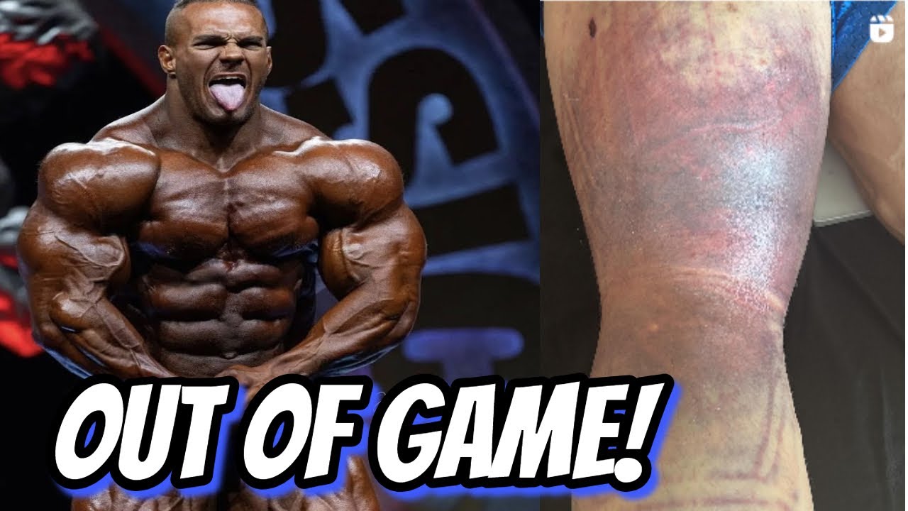 nick walker injured | All about Olympia | Olympia update 2023 - YouTube