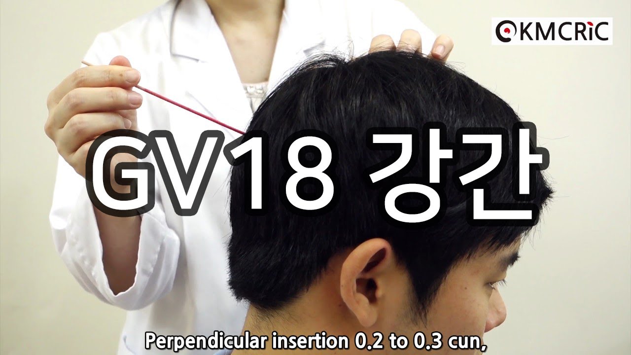 GV18 강간 强間 Qiangjian (Eng sub) - KMCRIC WHO Standard acupoint DB - YouTube