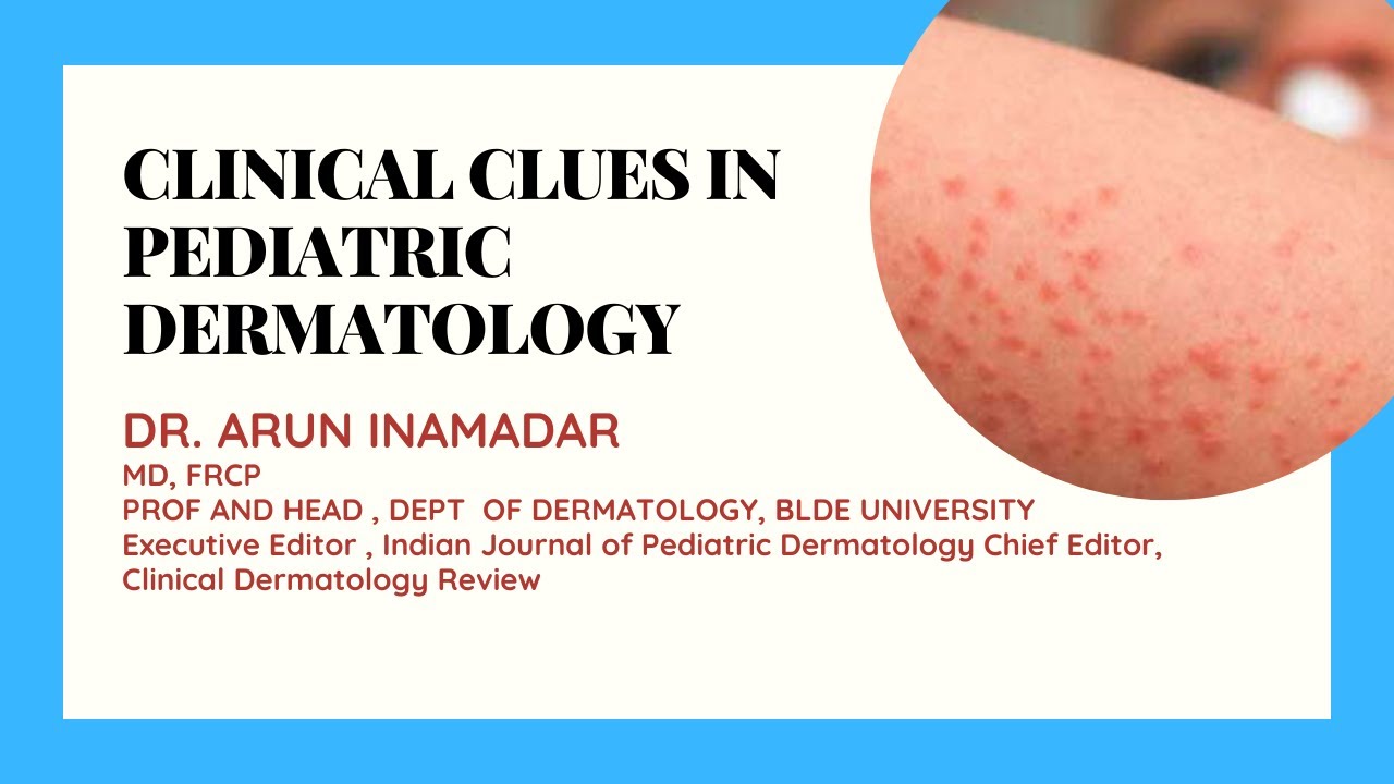 CLINICAL CLUES IN PEDIATRIC DERMATOLOGY | Dr. Arun Inamadar - YouTube