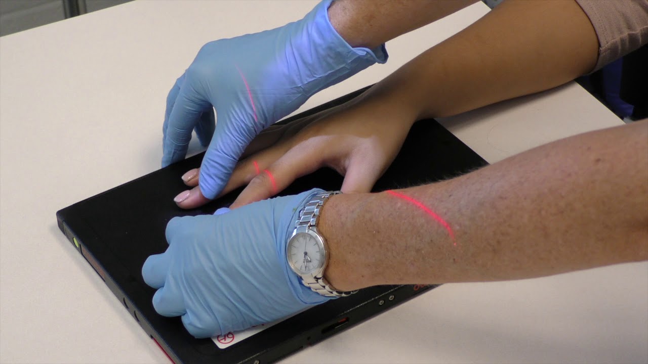 Digits 2 5: X Ray - YouTube