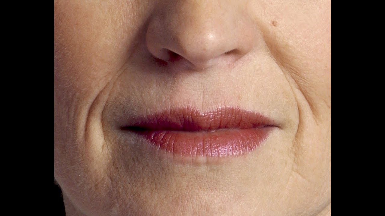 Erase Smile Lines with this EASY Trick! - YouTube