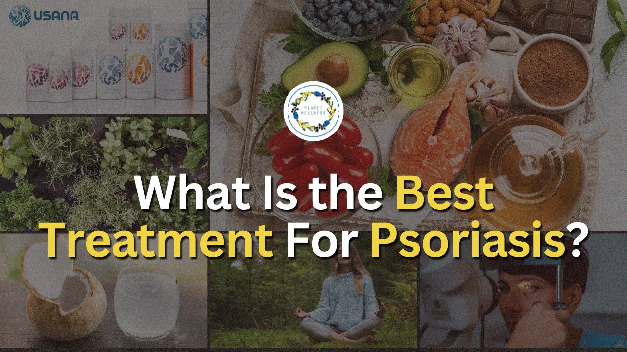 What is the best treatment for Psoriasis? - YouTube