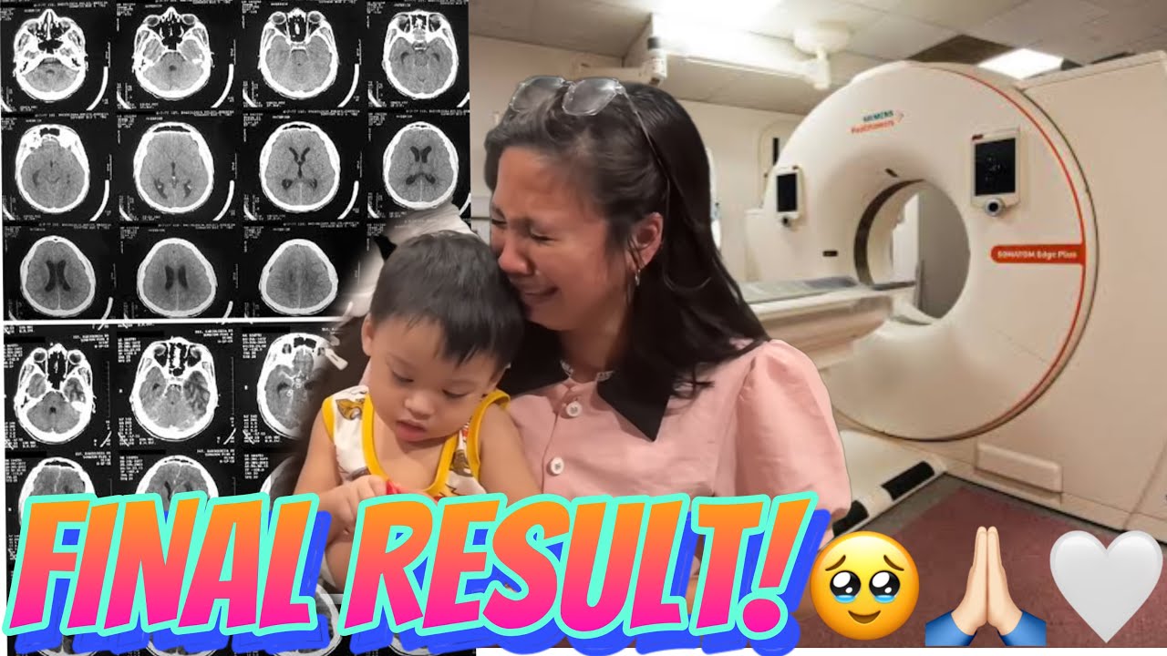NAKAKAIYAK ANG RESULTA NG CT SCAN NI GAB! - YouTube