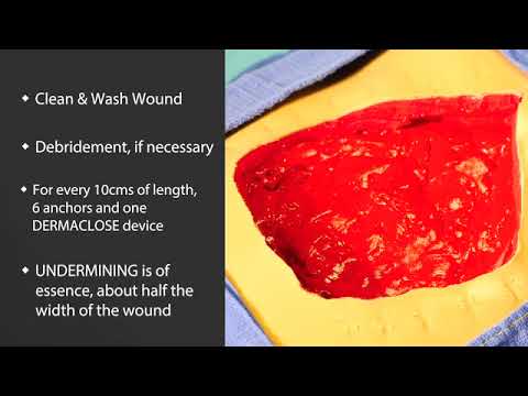 Dermaclose Lacing Video - YouTube