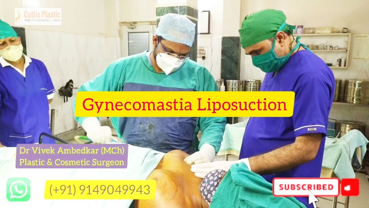 Gynecomastia Surgery | Grade 2 Gynecomastia Liposuction | Pratapgarh ...