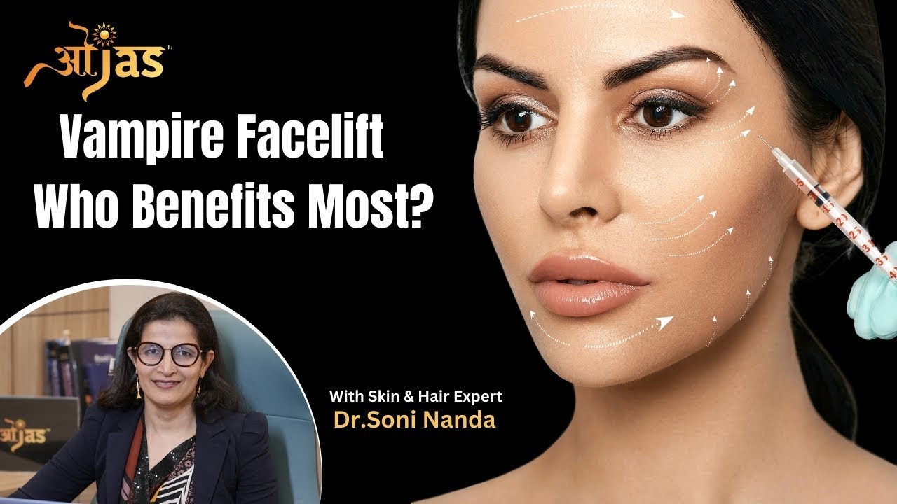 Don't Just Face It, Vampire It! PRP for Hair Loss & Glowing Skin Dr ...