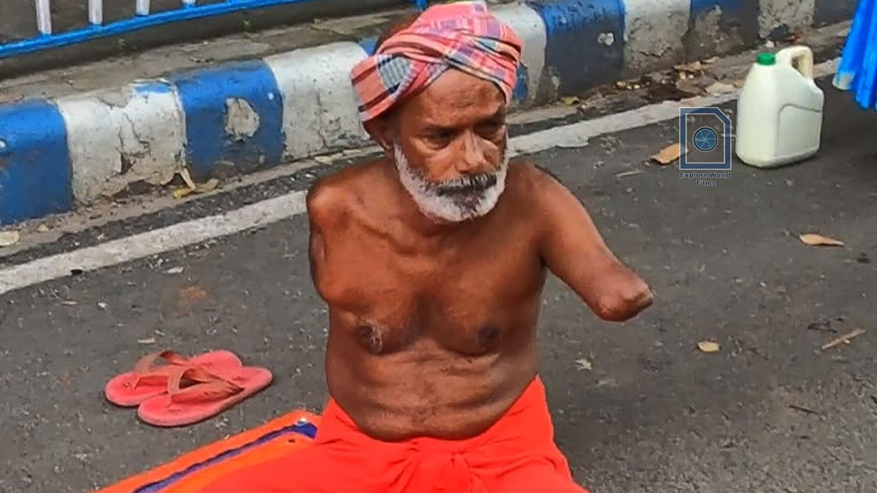 The Beggar Man Without Hands - YouTube