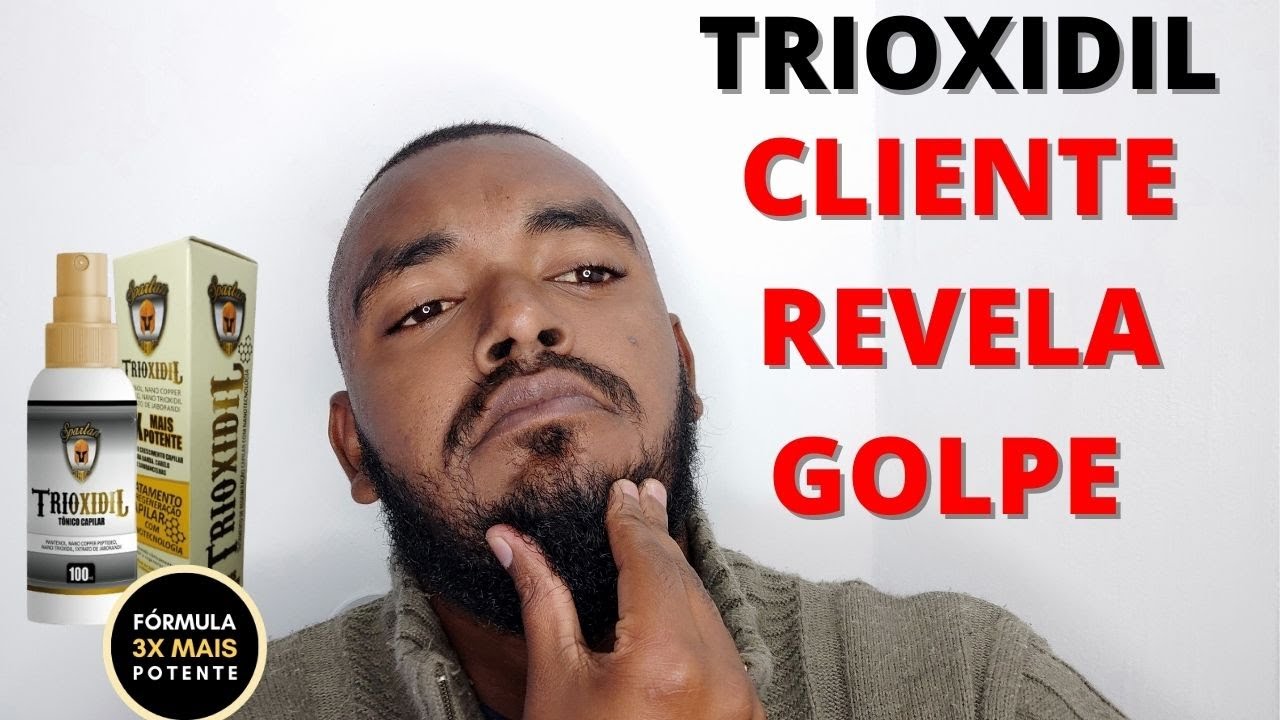 Trioxidil 🔴 Atenção Trioxidil Antes E Depois - Trioxidil É Bom ...