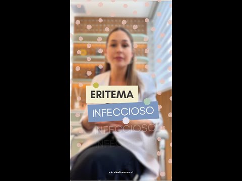 ERITEMA INFECCIOSO - Você já ouviu falar nessa doença?