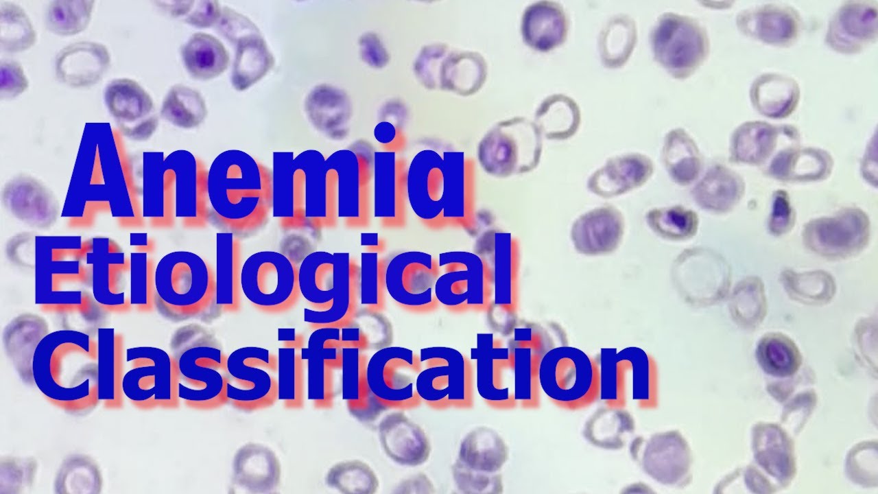 ANEMIA ETIOLOGICAL CLASSIFICATION - YouTube