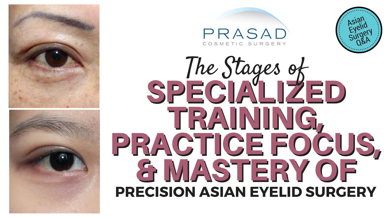 Asian Eyelid Anatomy