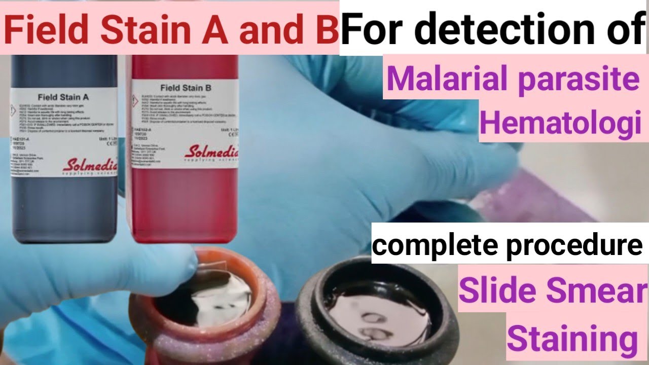 Field stain A and B | blood smear | staining #viralvideo #youtube # ...