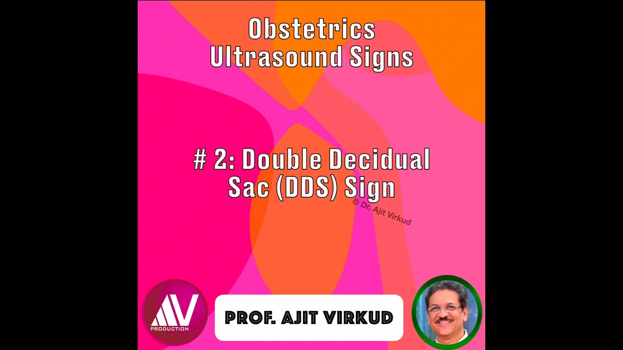 Double Decidual Sac (DDS) Sign - YouTube