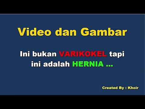 Video dan Gambar Cara Membedakan Antara Varikokel dan Hernia dengan ...
