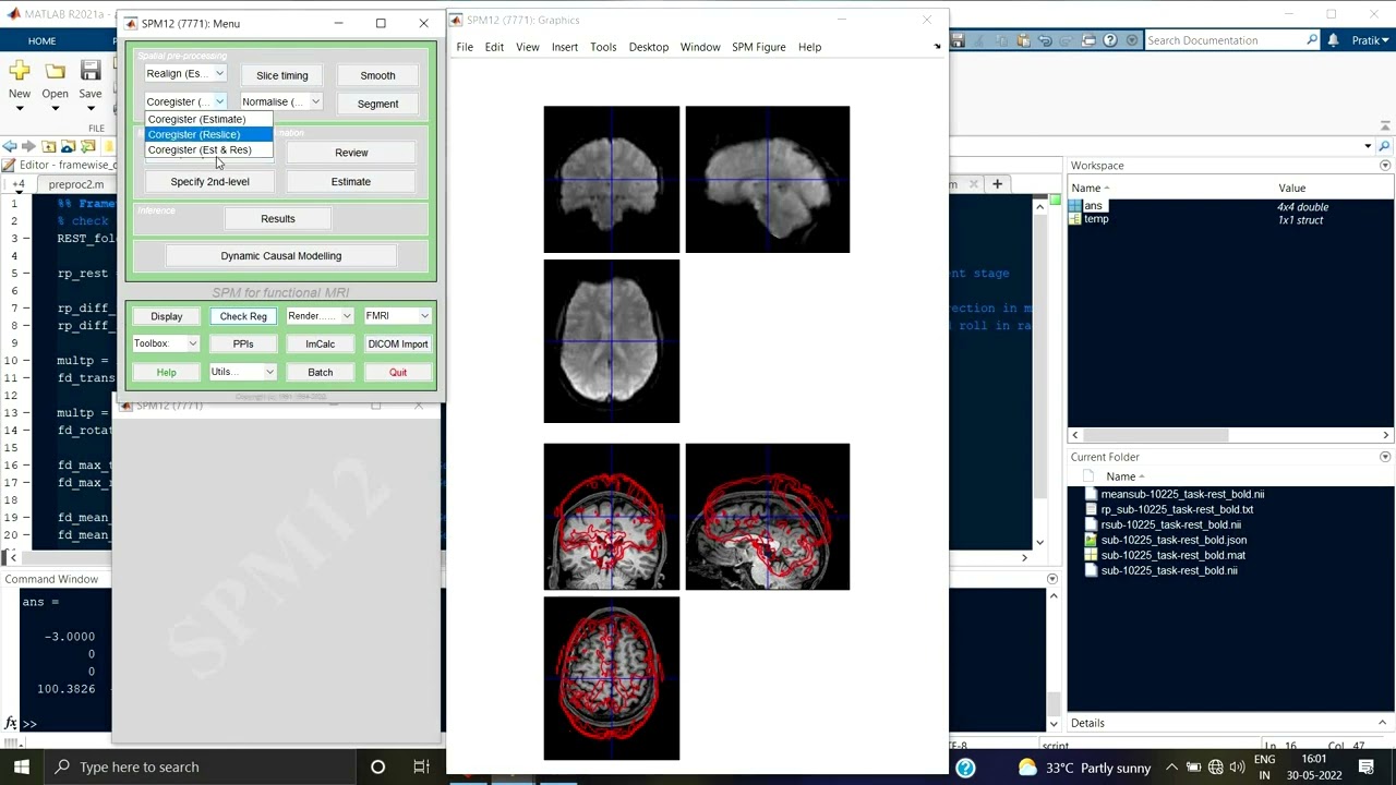 Co-registration of Functional and Anatomical Images | SPM | MATLAB ...