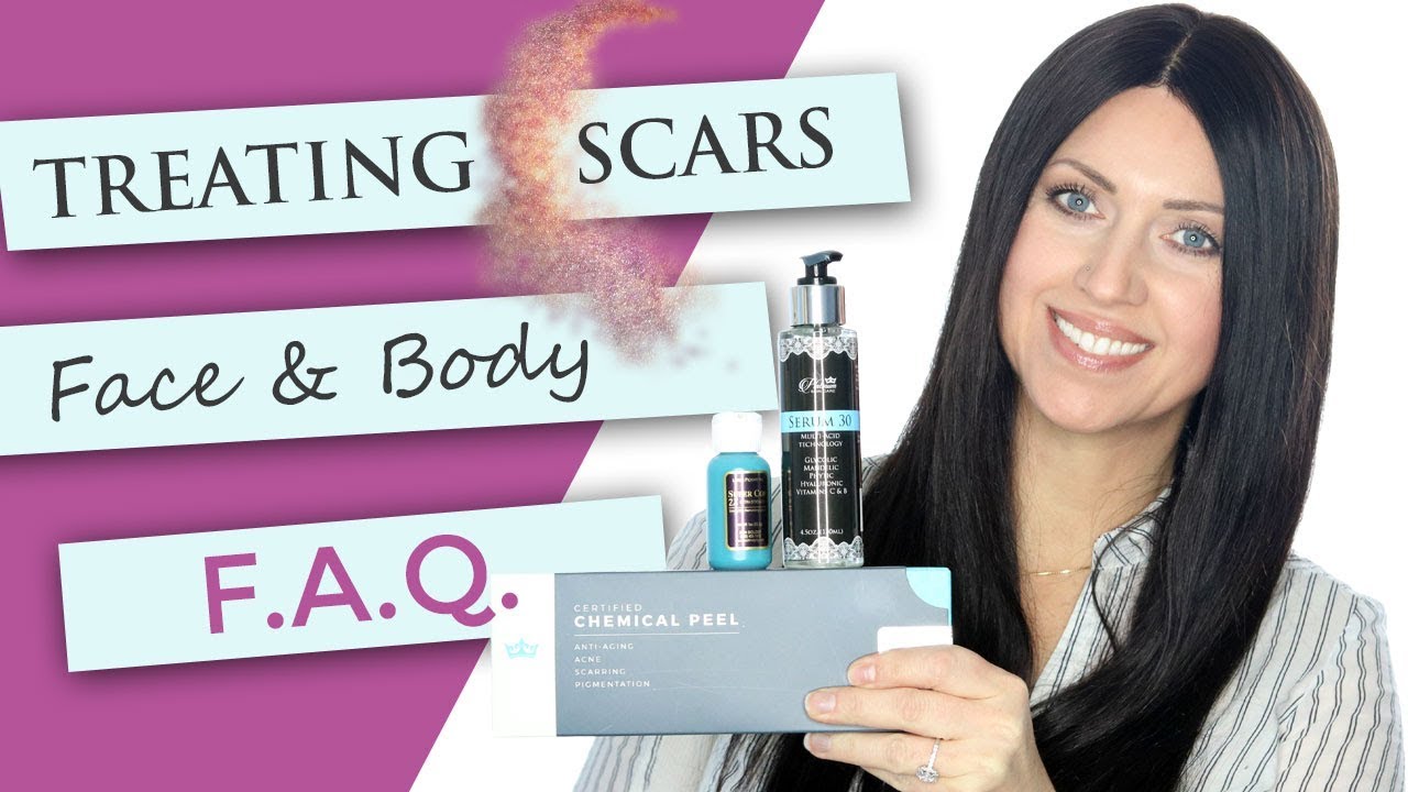 Scar treatment: Face & Body | Chemical peels | Copper | Acids - YouTube