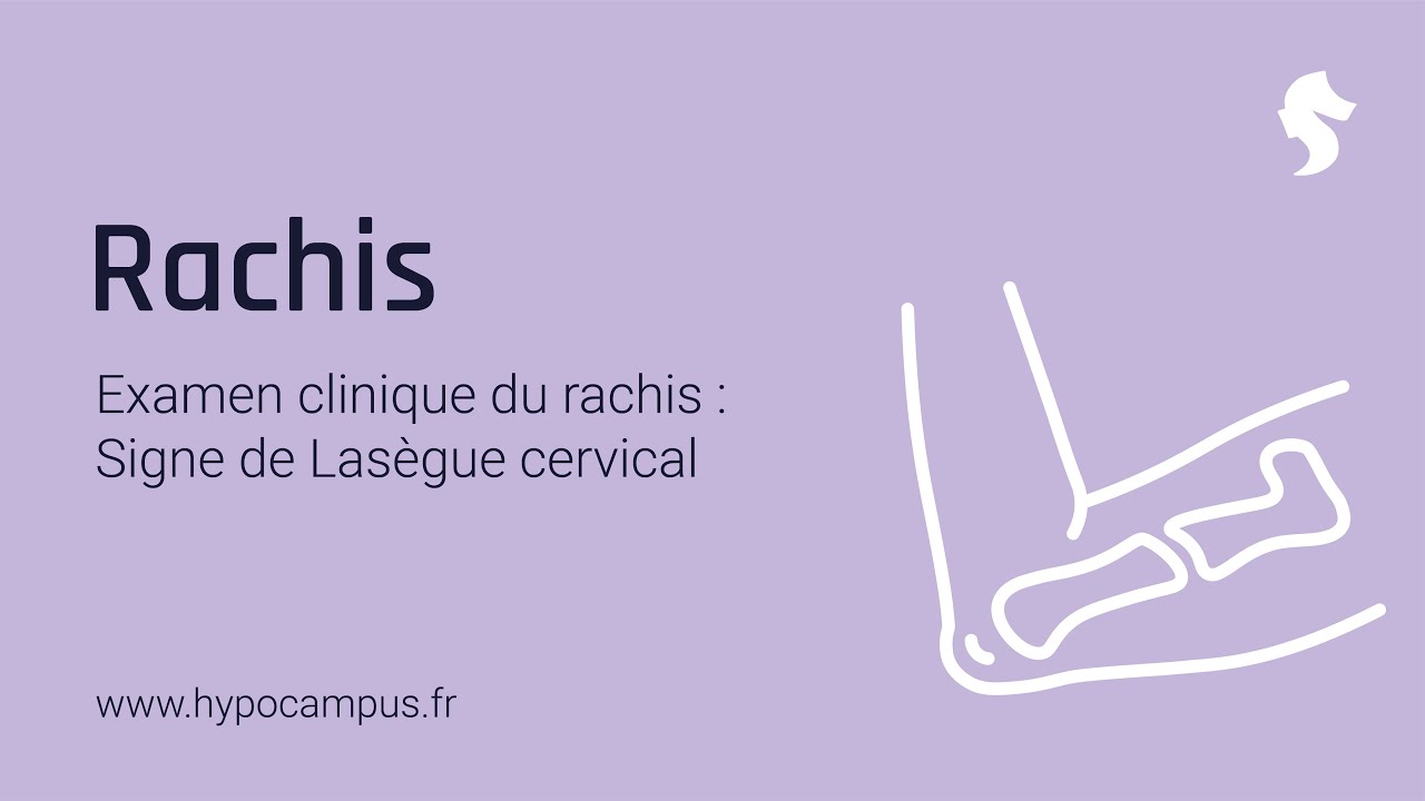 Examen Clinique du Rachis - Signe de Lasègue Cervical - YouTube