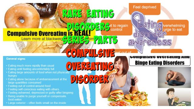 Rare Eating Disorders Part5 (Obsessive Compulsive Overeating Disorder ...