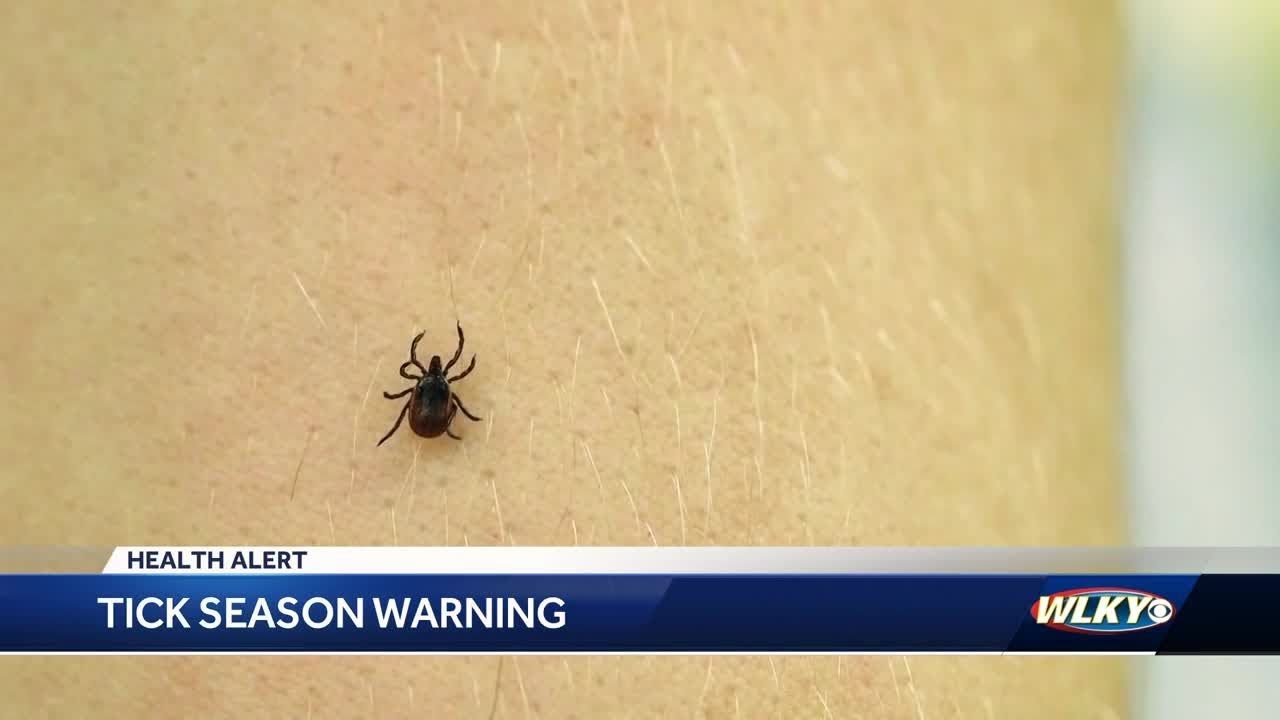 UofL Health warns the start of tick season - YouTube