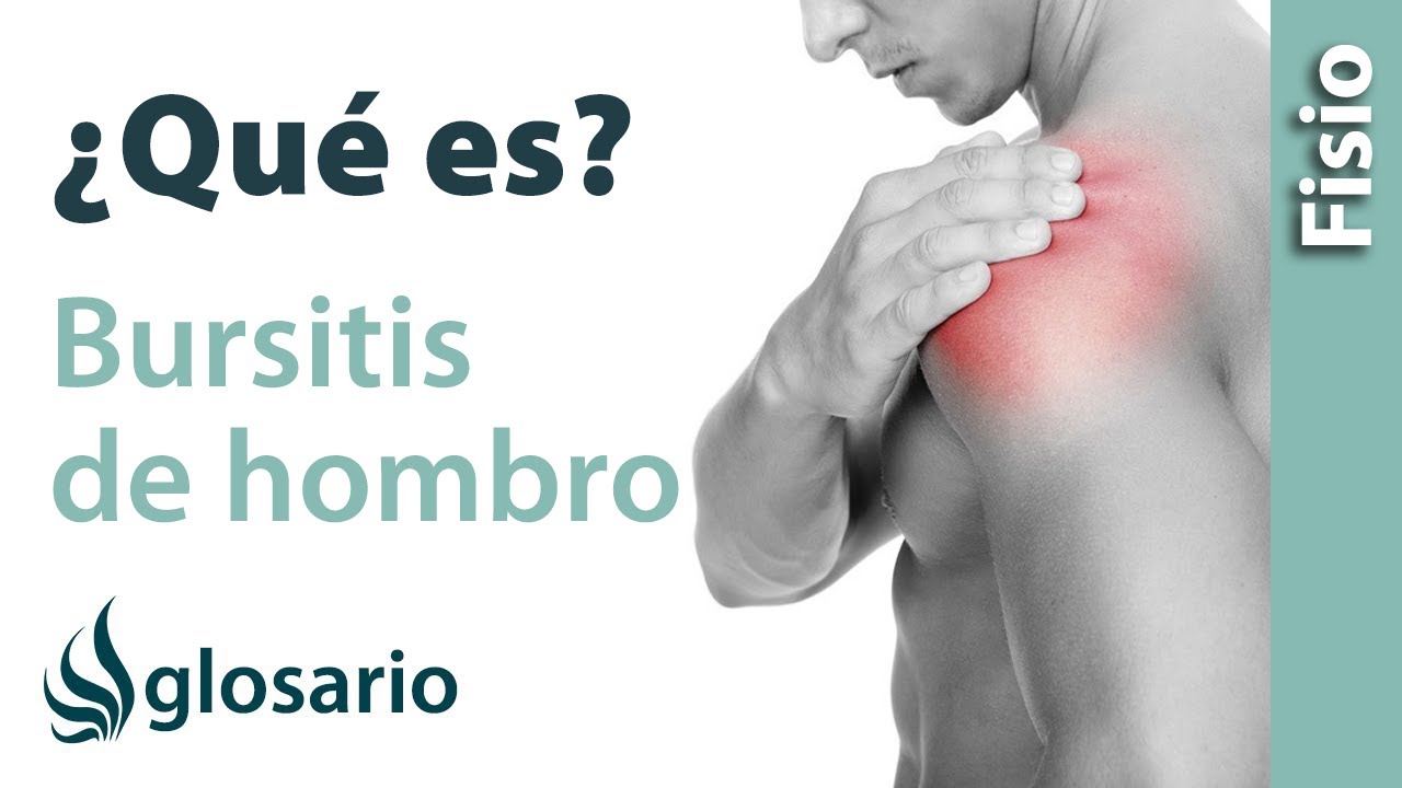 BURSITIS DE HOMBRO | ¿Qué es? - YouTube