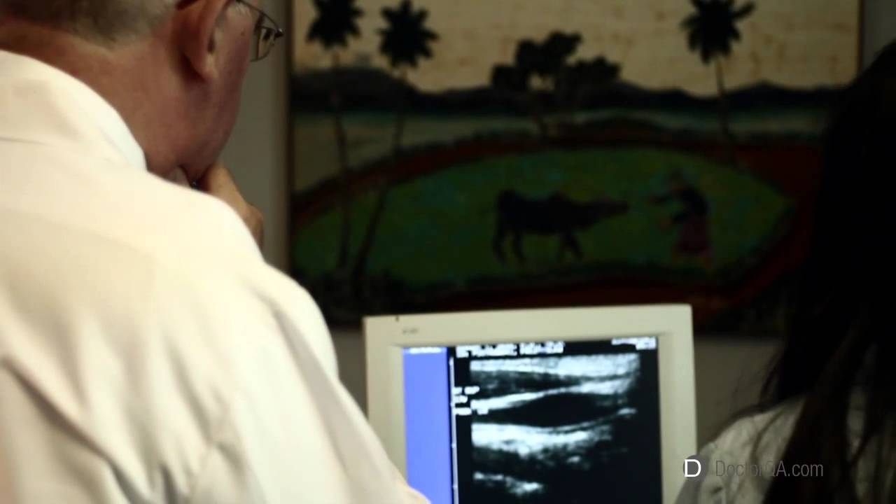 Will exercise alone help treat my varicose veins? - Dr. Steven Deak, MD ...