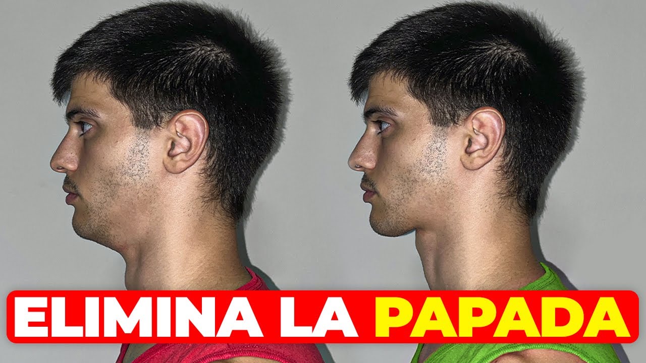 ELIMINA la PAPADA rápidamente (guía para principiantes) - YouTube