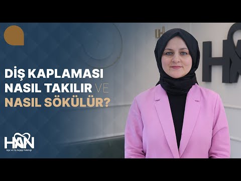 Diş Kaplaması Nasıl Takılır ve Nasıl Sökülür?