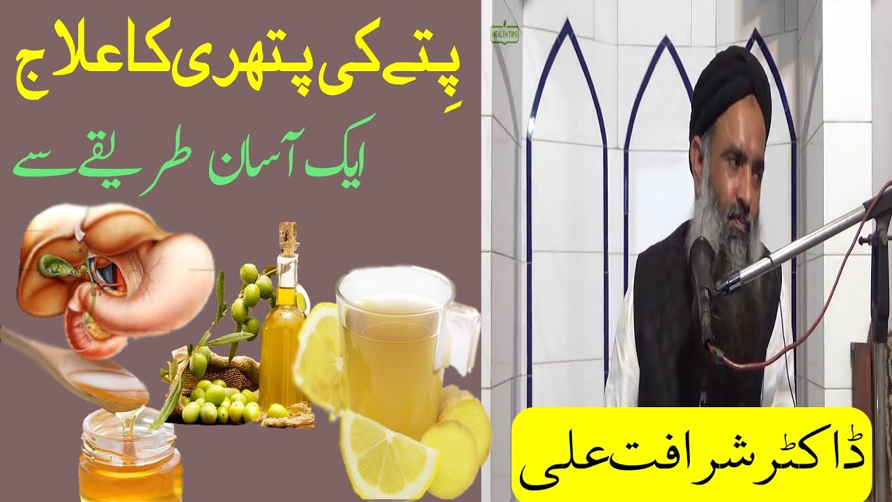 Pitte ki pathri ka ilaj پتے کی پتھری पित्ताशय की थैली की पथरी by Dr ...