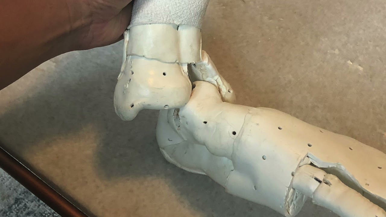 Ankle Dislocation with fracture / Big Toe Dislocation combo simulator ...